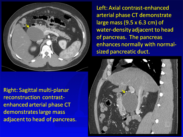 Gastrointestinal - Learning Modules - CTisus.com CT Scanning