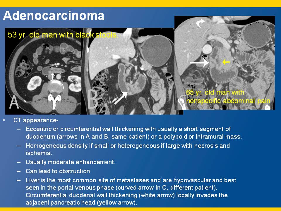Genitourinary Learning Modules Ct Scanning