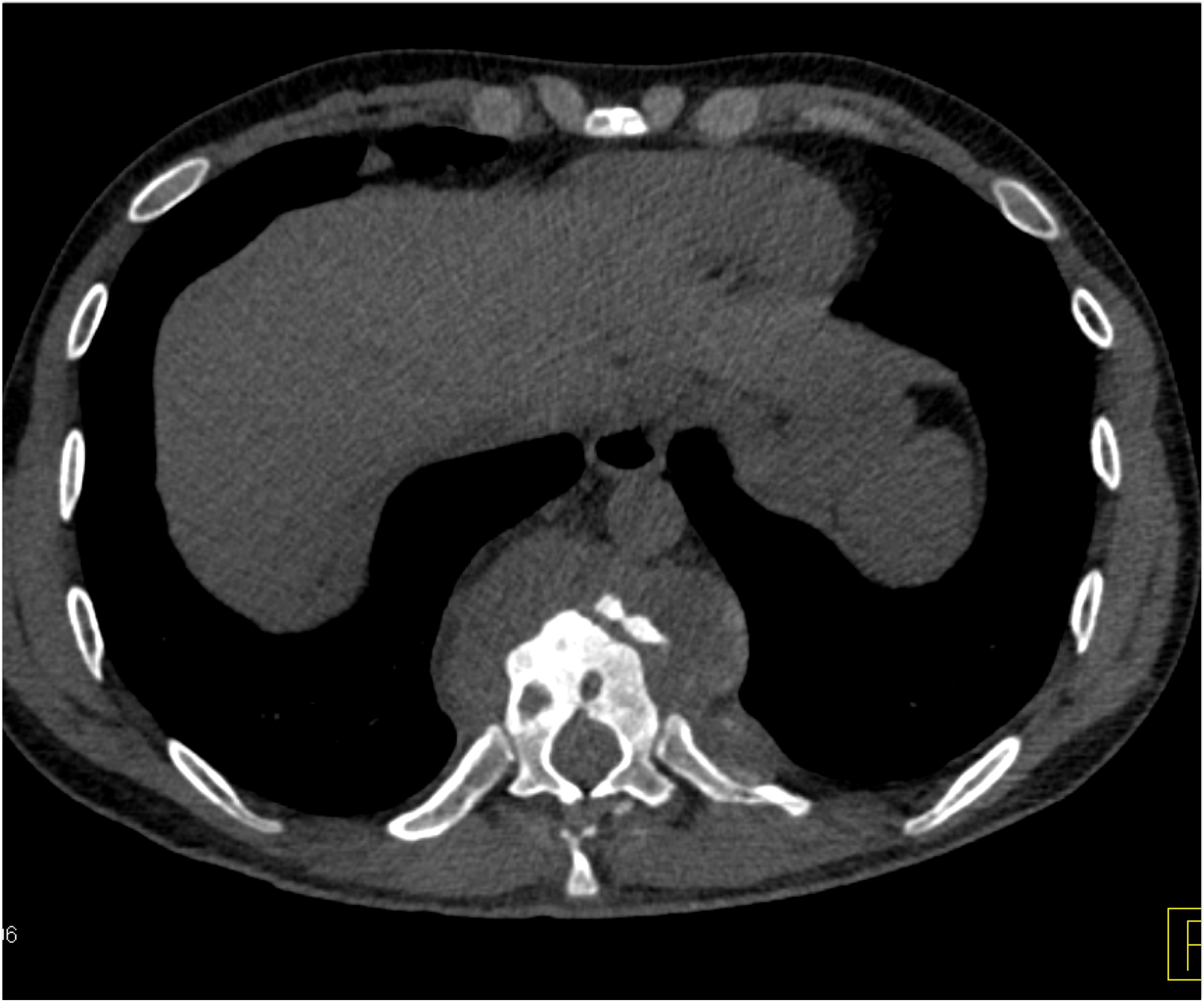 Musculoskeletal Anatomical Region Quiz Educational Tools CT